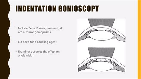 Gonioscopy Pptx