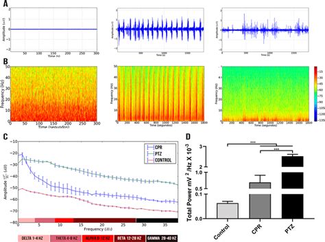 Electrocorticographic Recordings And Linear Frequency Distributions In Download Scientific