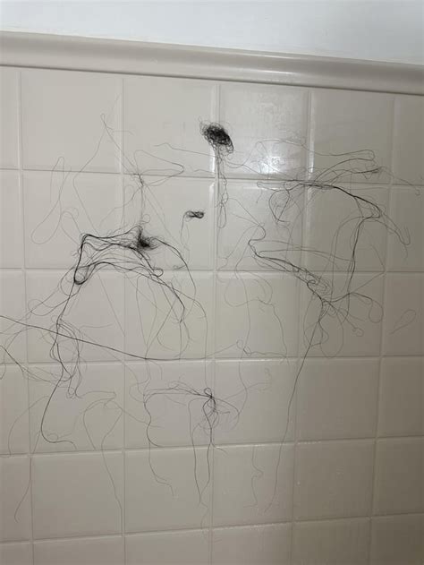 Finasteride Vs Dutasteride Vs Minox Rfemalehairloss