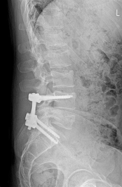 Swapify Cross Chain Token Swapping Dapp On Astar Network Dapp