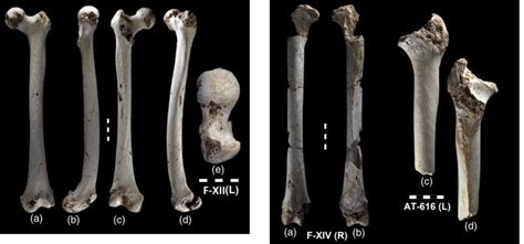 Main Morphological Characteristics And Sexual Dimorphism Of Hominin Adult Femora From The Sima