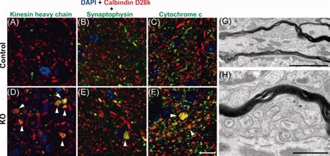 Intense Staining For Mitochondria Synaptic Vesicles And Kinesin Heavy