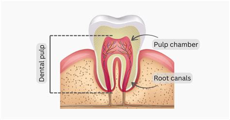 Pulpotomy Vs Pulpectomy Differences In Primary Teeth Treatment Share
