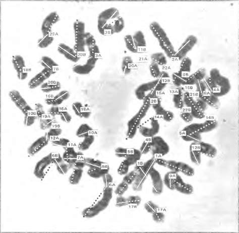 Photograph Of A Human Metaphase Spread With The Location Of The