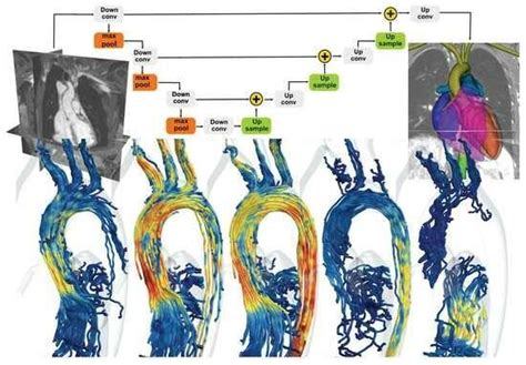 Marco Laudato On Linkedin Machine Learning Based Segmentation Of The