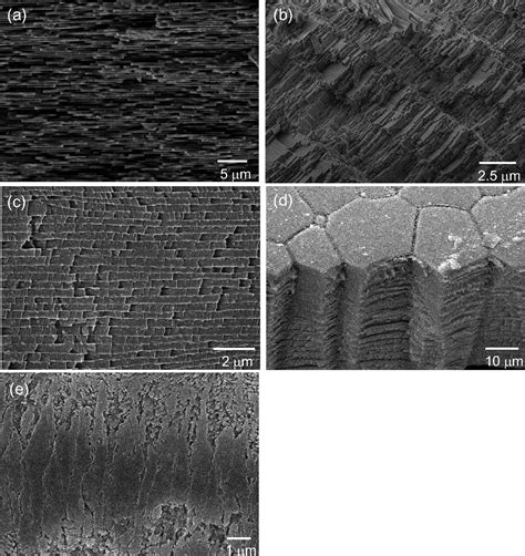Mollusca Shell Diagram
