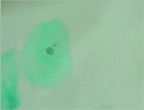 Oral Buccal Mucosal Cells Having Mn Download Scientific Diagram