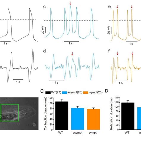 Action Potential Ap Characteristics Of Ventricular Like Cms