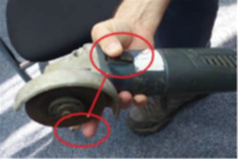 Injury To Fingers During Grinding Activity