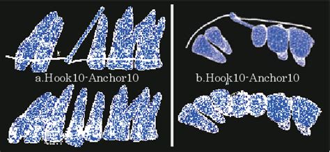 Figure 5 From Finite Element Analysis Of Stress In Maxillary Dentition During En Masse