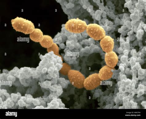 Lactobacillus Bulgaricus And Streptococcus Thermophilus