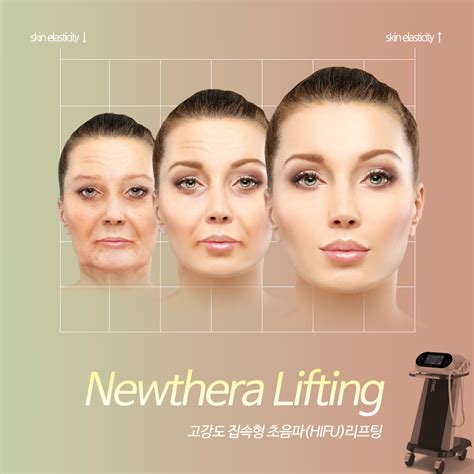 상상하다 뉴테라레이저는 Hifu고강도 집속 초음파를 사용하여 피부 탄력과 리프팅 피부 톤