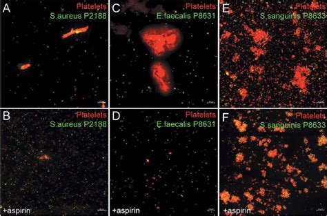 Confocal Laser Scanning Light Microscopy Of Control Or Aspirin
