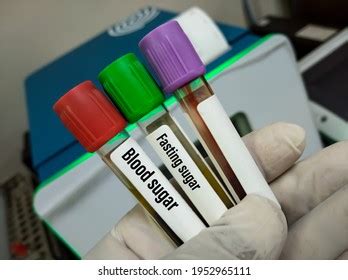 Fasting Blood Glucose Images Stock Photos Vectors Shutterstock