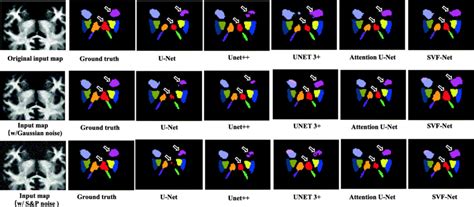 2d Brain Structure Segmentation Visualization Under Different Noise