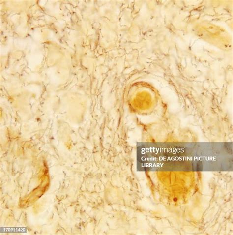 Syphilis Microscope Photos And Premium High Res Pictures Getty Images