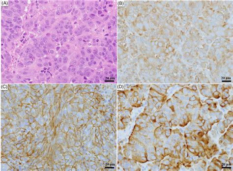 Histological And Immunohistochemical Findings Histopathology Of The Download Scientific