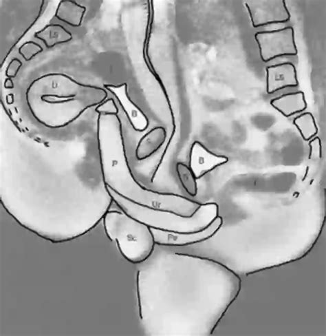 Couples Had Sex In Mri Scanners In The Name Of Science