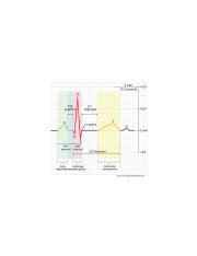 ECG EKG Waveform Pqrst Explained Png Course Hero