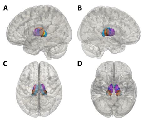 functional connectivity based targeting of thalamic nuclei for dbs