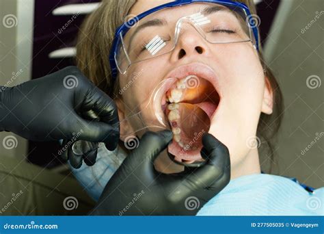 Examination Of Oral Cavity In Mirror Stock Image Image Of Health Caries 277505035