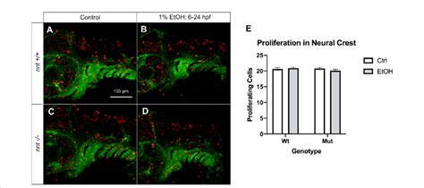 Proliferation Is Not Significantly Altered In Neural Crest Of Nnt Download Scientific Diagram