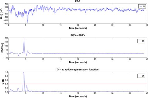 Result Of Automatic Segmentation Using Fractal Dimension On Occipital Download Scientific