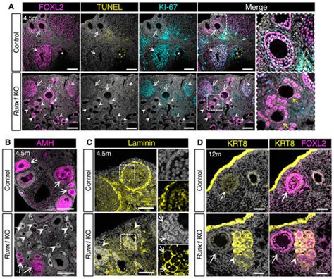 Loss Of Runx1 Induces Granulosa Cell Defects And Development Of Ovarian Tumors In The Mouse