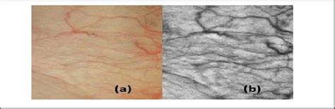 Segmentation Of Sclera Using K Means Clustering Algorithm A Original