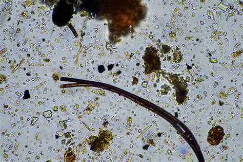 Fungi Under Microscope Images Free Download On Freepik