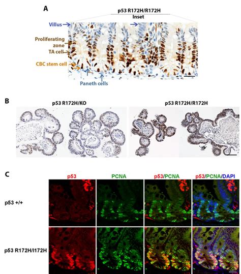 Mutant P53 Accumulates In Cycling And Proliferating Cells In The Normal Tissues Of P53 R172h
