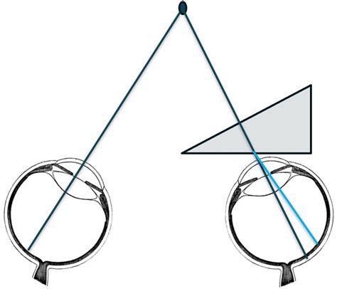 ophthalmic prism everything you need to know as an optometrist