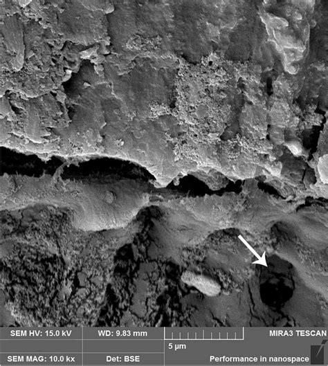 A Cracked Resin Dentin Interface With A Thin Hybrid Layer And Shortened Download Scientific