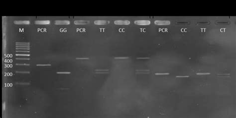 Genotypes Of Pcr Rflp For The Igf 1 Lep And Prlr Genes M Thermo Download Scientific Diagram