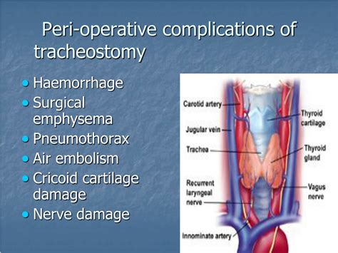 Ppt Care Of The Patient With A Tracheostomy Powerpoint Presentation