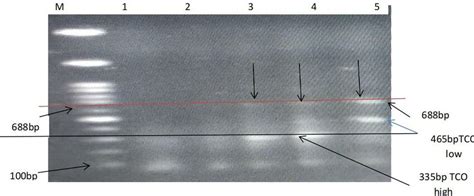 Progress Of Pcr Product Optimization Run On A 1 5 Agarose Gel Of Pcr Download Scientific Diagram