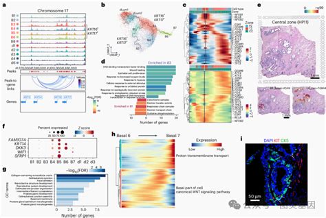 Nat Genet ｜ 长征医院：前列腺单细胞图谱揭示起源细胞 知乎