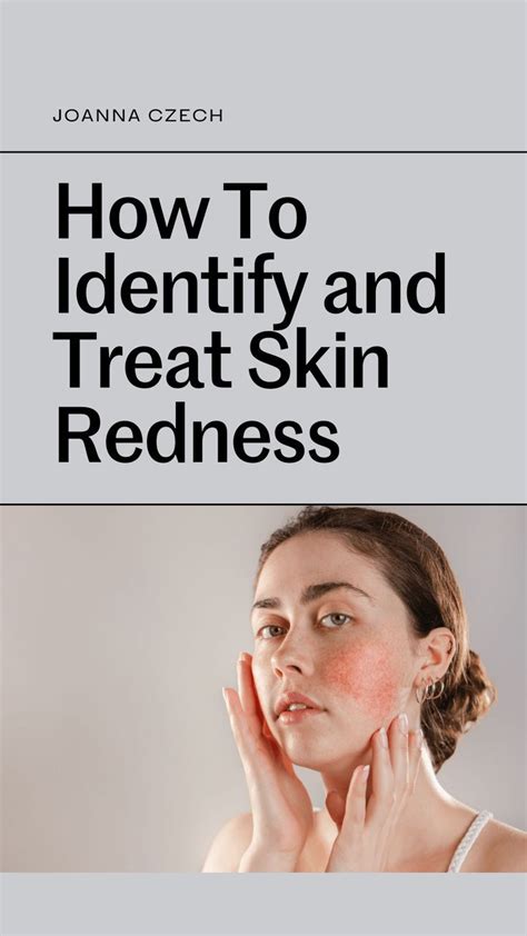 How To Identify And Treat Skin Redness Skin Redness Treat Skin Redness