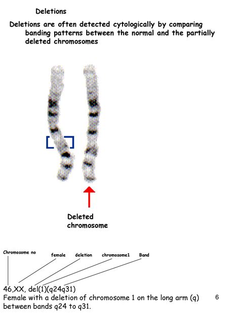 Deletion Of Chromosome 1