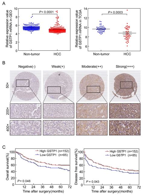 High Gstp1 Inhibits Cell Proliferation By Reducing Akt Phosphorylation