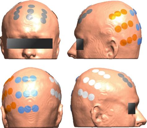 Fig 102 Surface Representation Of The Head Brain And Human
