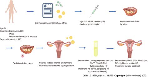 Heterotopic Pregnancy After Assisted Reproductive Techniques With
