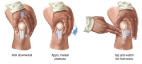 Ha Exam 4 Musculoskeletal Flashcards Quizlet