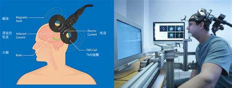 脑电硬件丨人类如何观测大脑？脑成像技术概览（上） 知乎