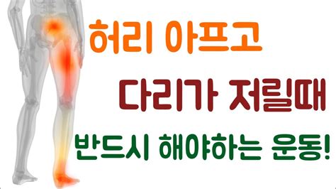 닥터홍선생 30허리가 아프고 다리 뒤쪽으로 저리다면 반드시 해야하는 운동 한 가지 Youtube