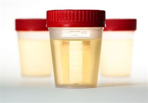 What Does My Pee Color Mean 9 Types Of Pee And Their Meaning Dietas