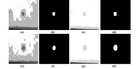 A Otsu Threshold For Mm Front B Extracted Region C Tsallis Download Scientific