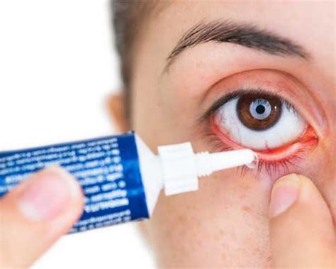 آموزش ریختن قطره و پماد چشمی