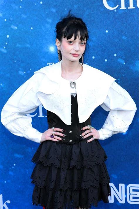 Irish Actress Ruth Codd Recovers After Second Leg Amputation Times News Global