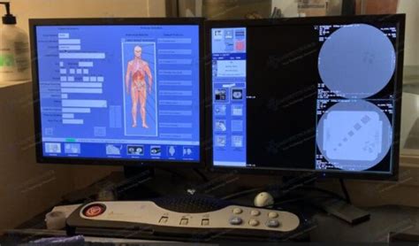 GE CT Reconstruction Error Troubleshooting Tips
